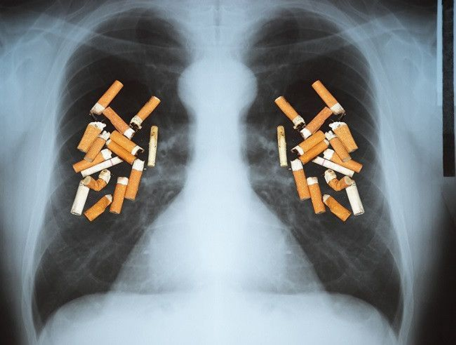 Cómo limpiar los pulmones de nicotina y alquitrán de forma natural